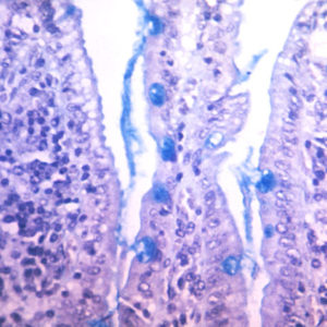 Vibrio cholerae - The Native Antigen Company