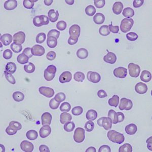 Plasmodium antigens - The Native Antigen Company