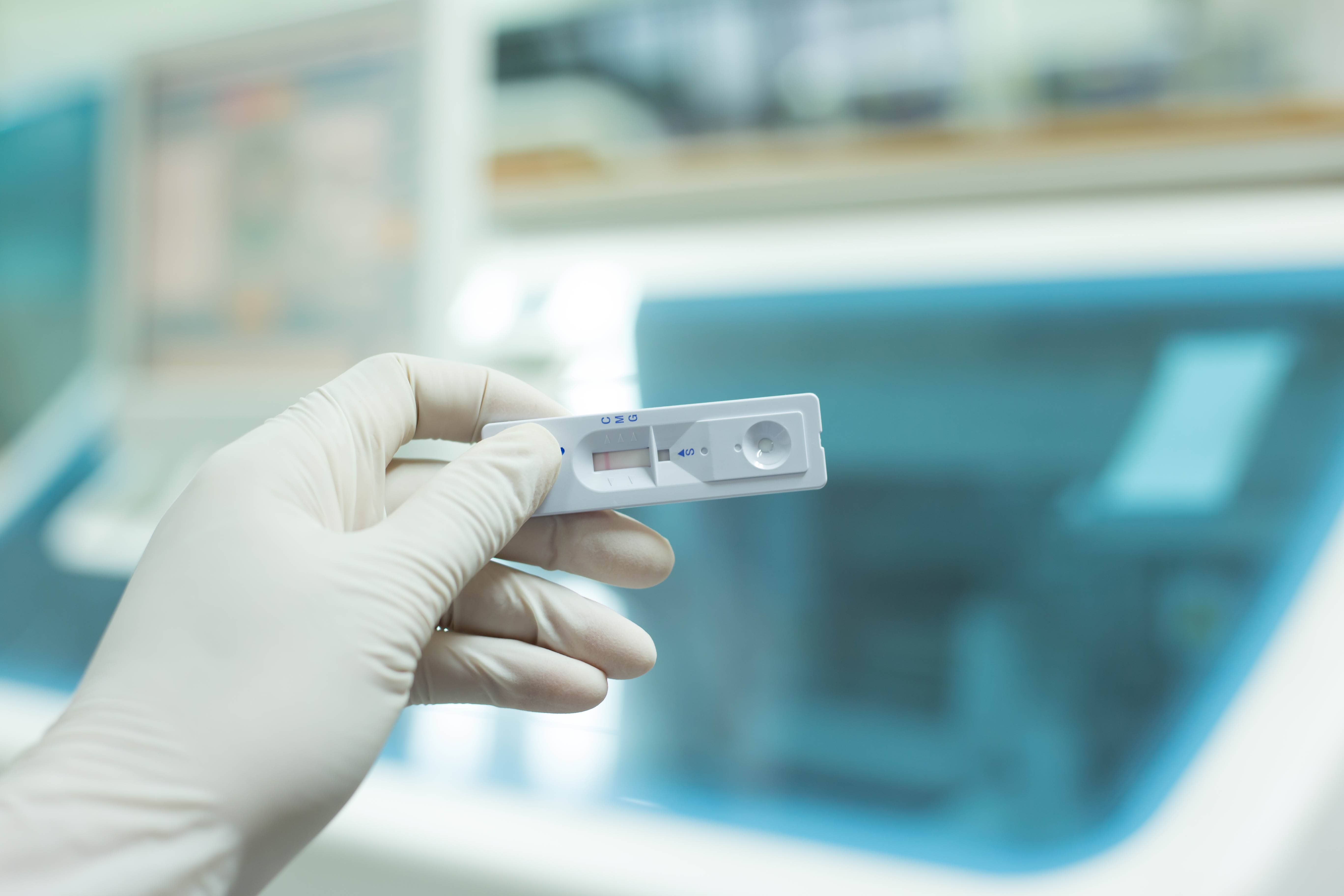 Reagents for Rapid Ebola Diagnostics - The Native Antigen Company