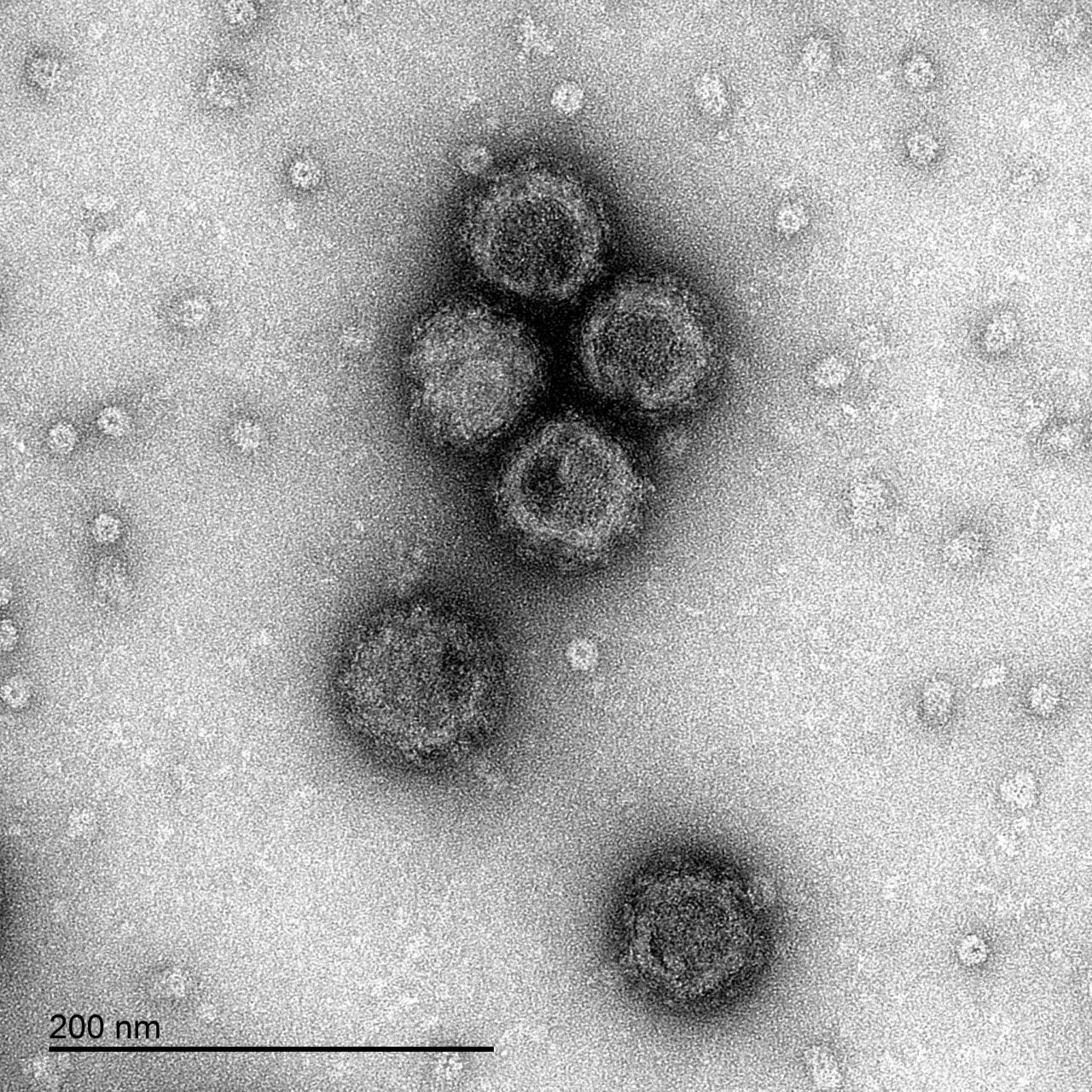 TEM images of our virus-like particles - The Native Antigen Company