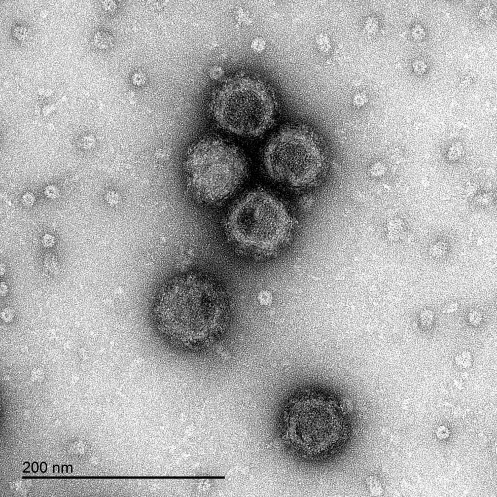 TEM images of our virus-like particles - The Native Antigen Company