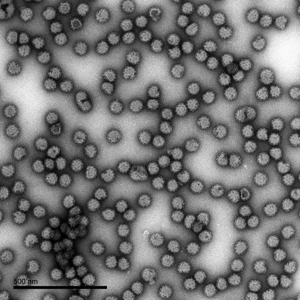 TEM images of our virus-like particles - The Native Antigen Company