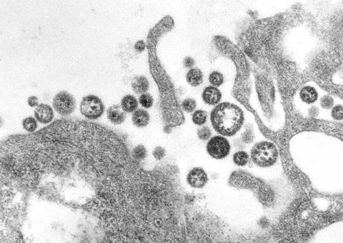 The Immune Evasion Strategies of Lassa Fever Virus - The Native Antigen ...