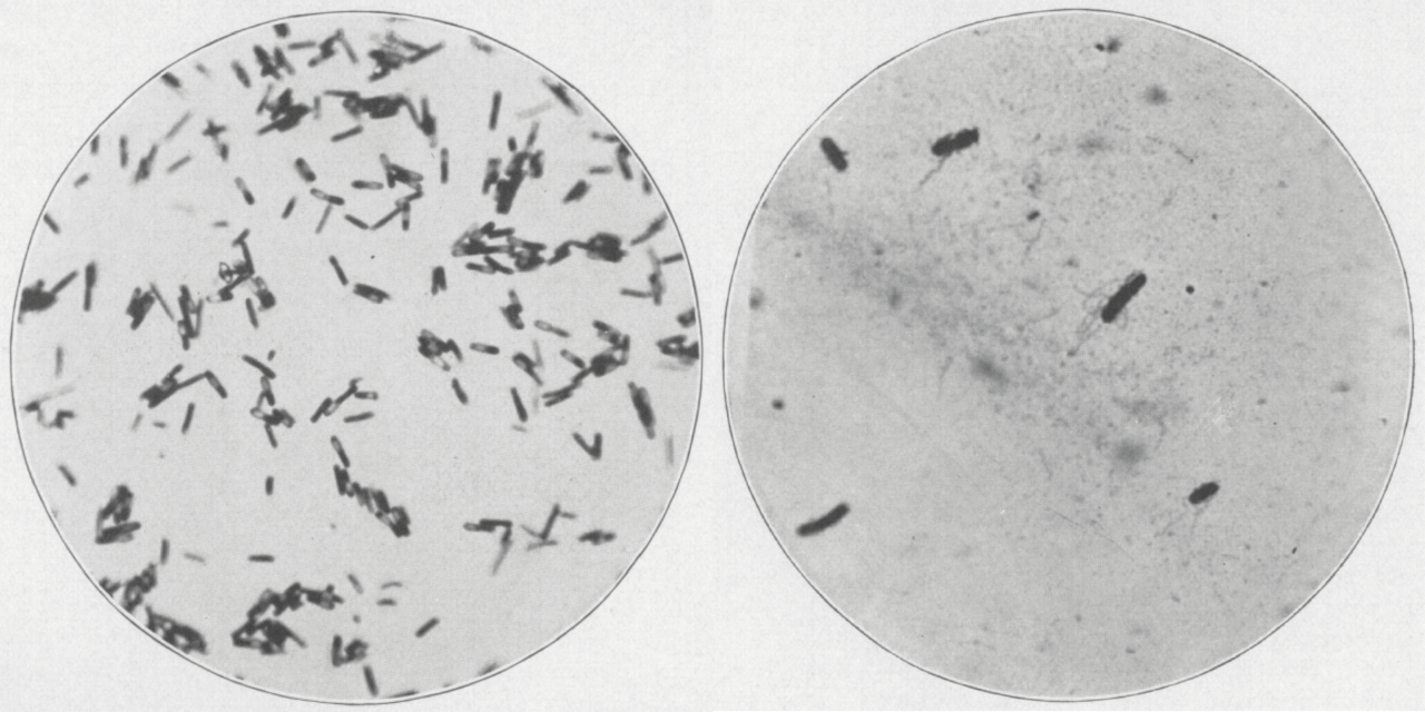Clostridium difficile Toxins: The Nuts and Bolts - The Native Antigen ...