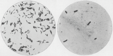 Clostridium difficile Toxins: The Nuts and Bolts - The Native Antigen ...