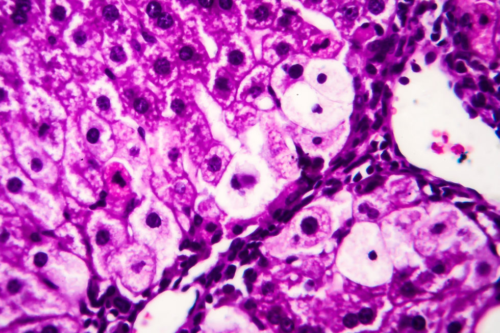 Where Are We At with CMV Vaccine Development? - The Native Antigen Company