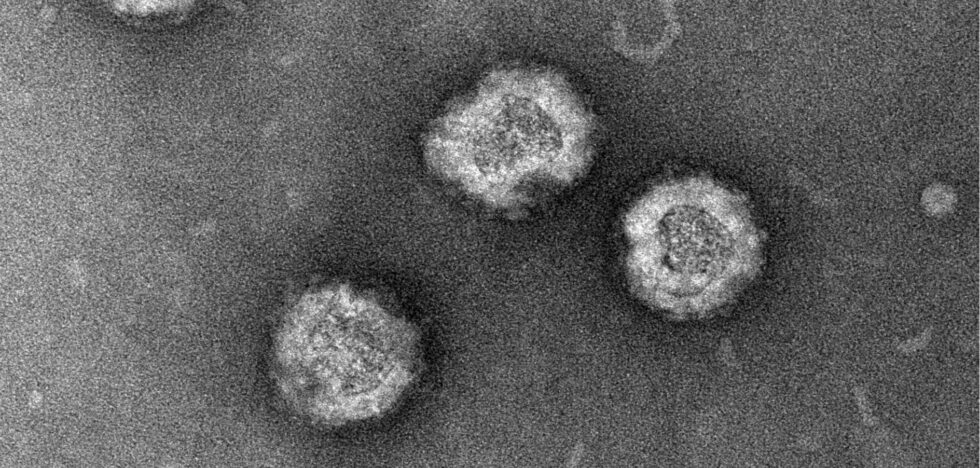 Virus-like particles – the new candidate of choice for diagnosing and ...